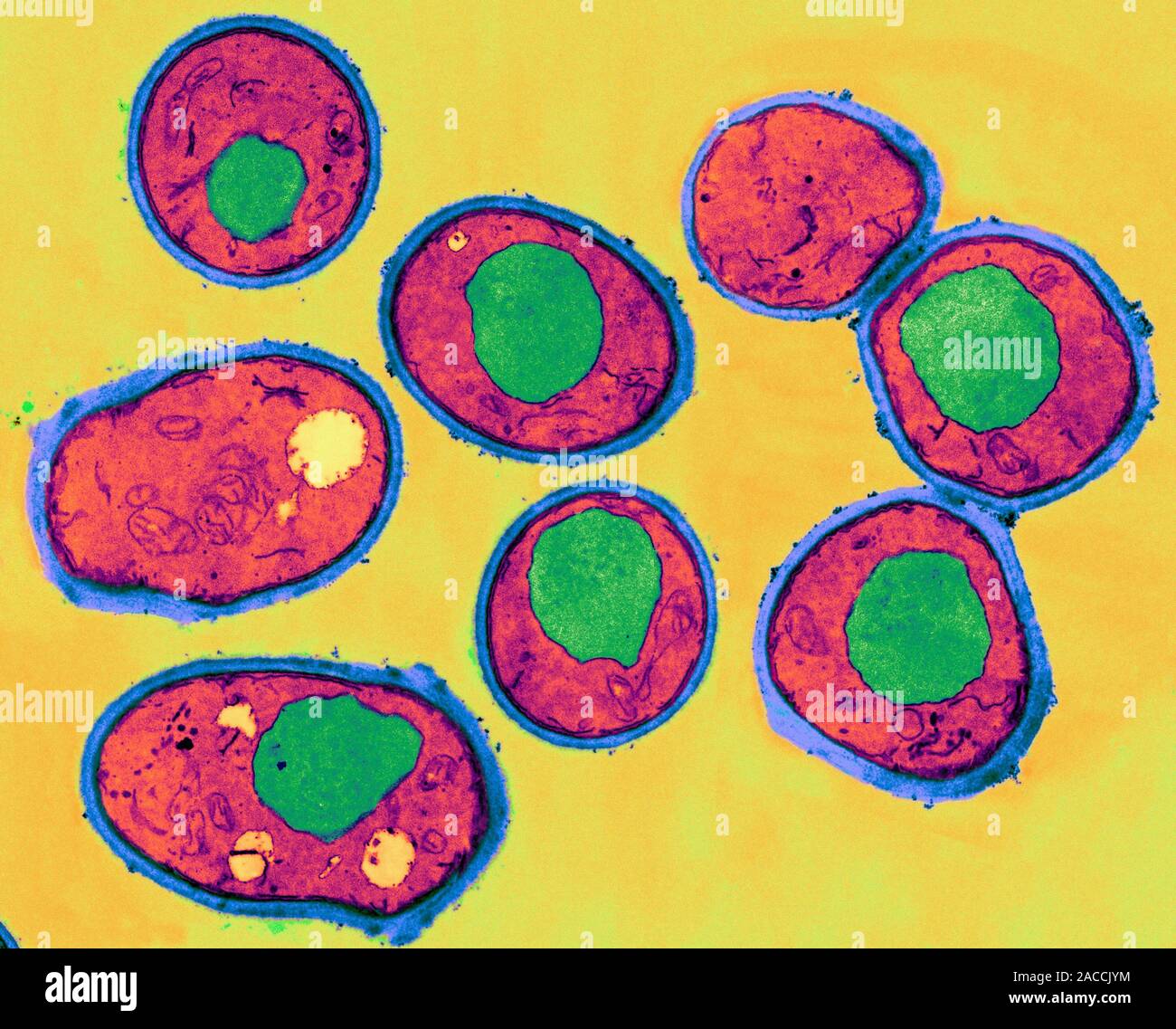 Yeast cells, coloured transmission electron micrograph (TEM). The cell ...