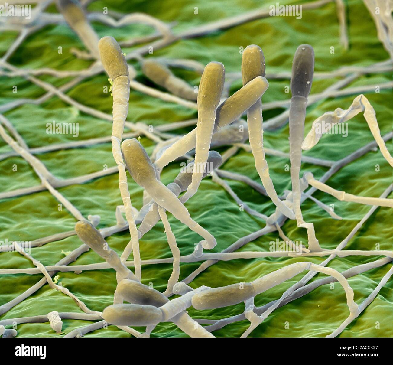Powdery mildew on a plant, coloured scanning electron micrograph (SEM ...