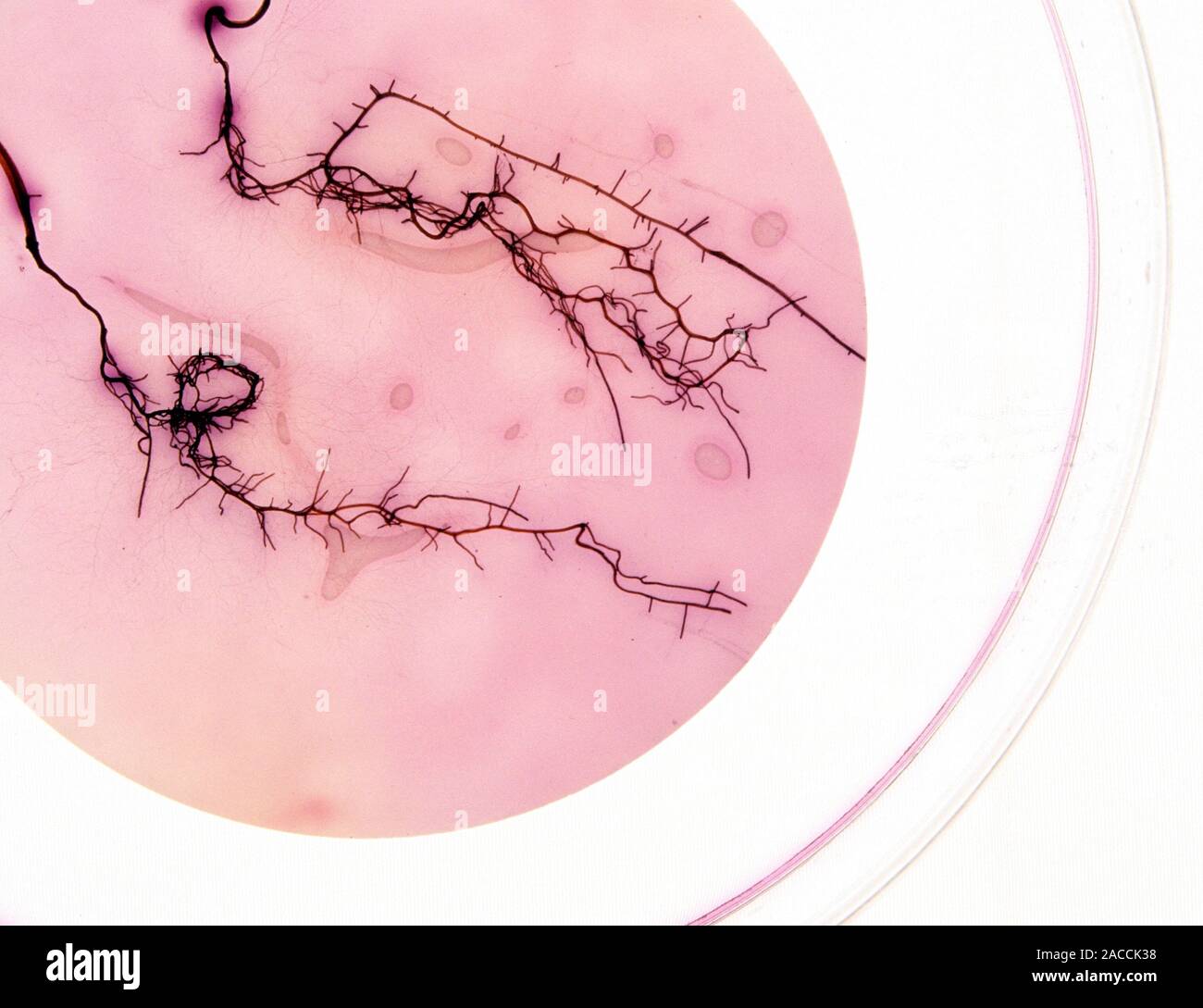 Mycorrhiza. Roots of two plants that have been inoculated with an ...