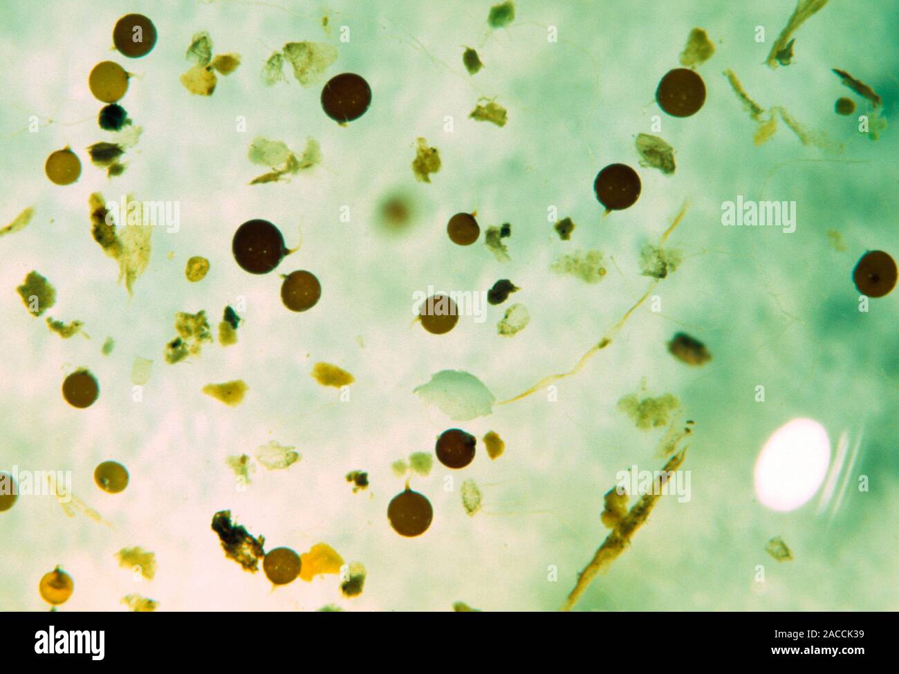 Germinating fungal spores. Light micrograph of mycorrhizal fungal ...