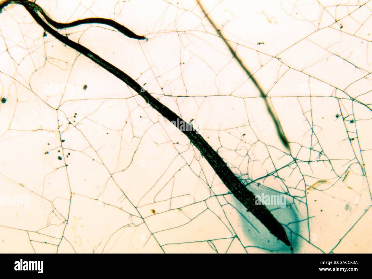 Germinating fungal spore. Light micrograph of mycorrhizal fungal spore ...