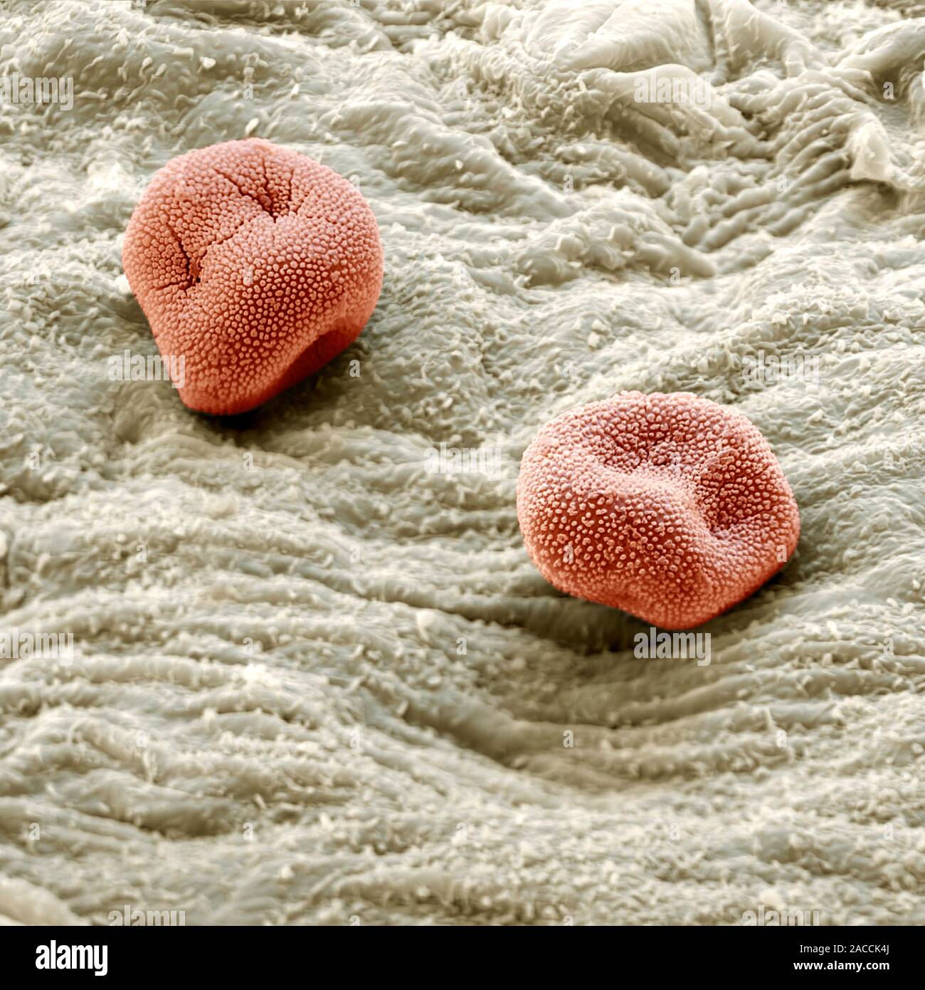 Rust fungus spores. Coloured scanning electron micrograph (SEM) of two ...