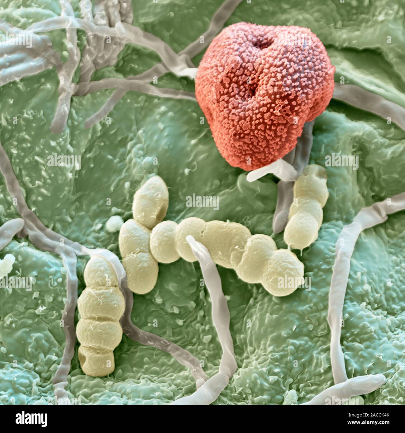 Rust fungus spore. Coloured scanning electron micrograph (SEM) of a ...