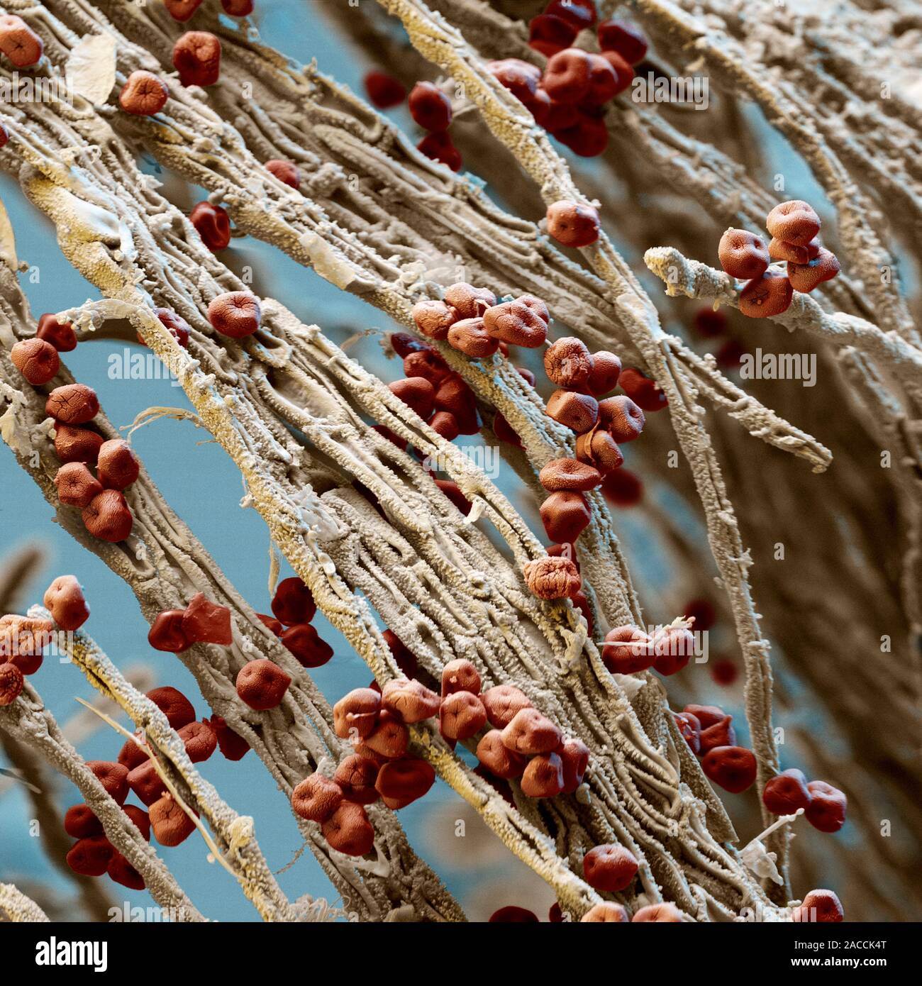 Rust fungus. Coloured scanning electron micrograph (SEM) of ...