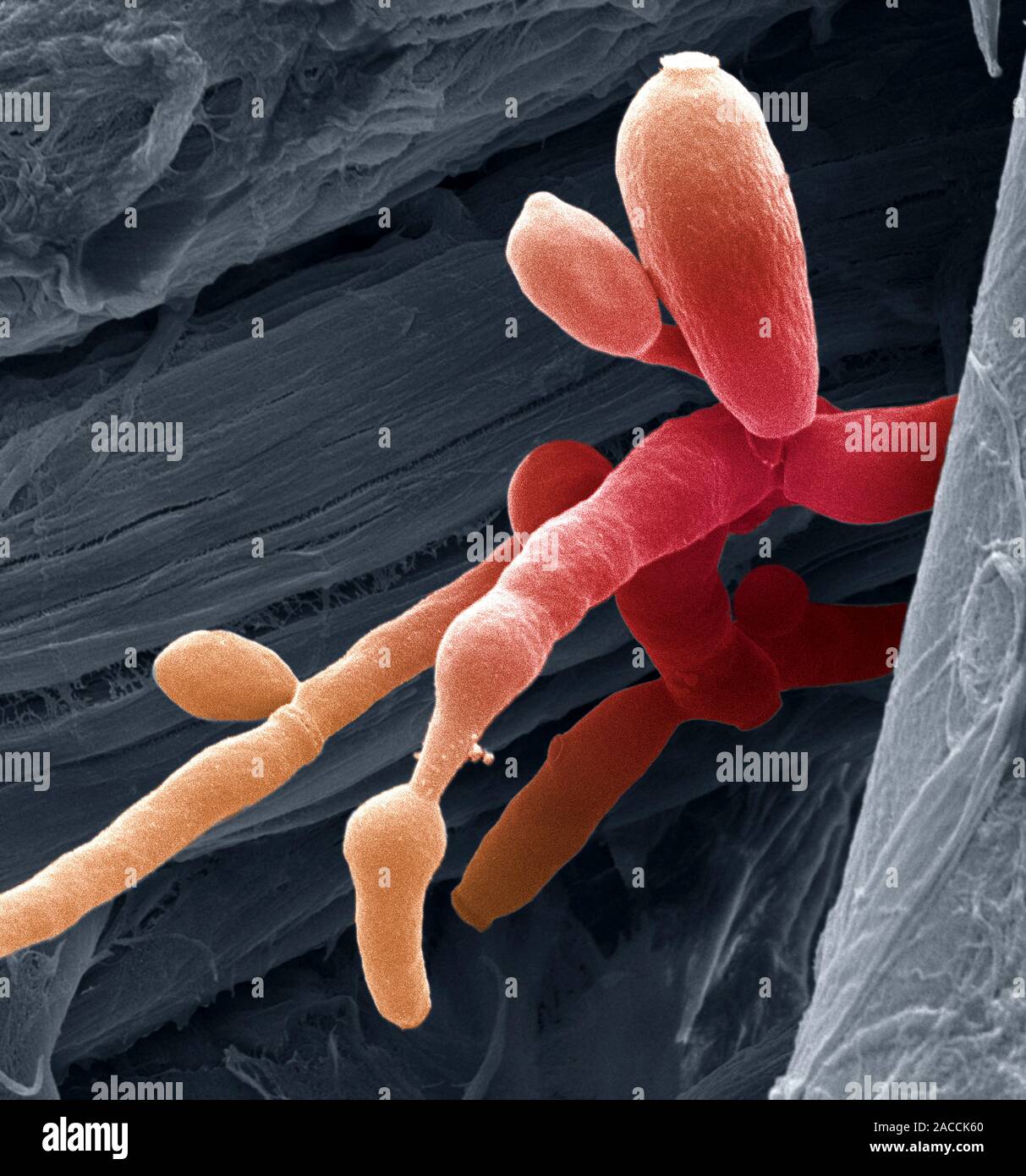 Candida fungus. Coloured scanning electron micrograph (SEM) of budding ...