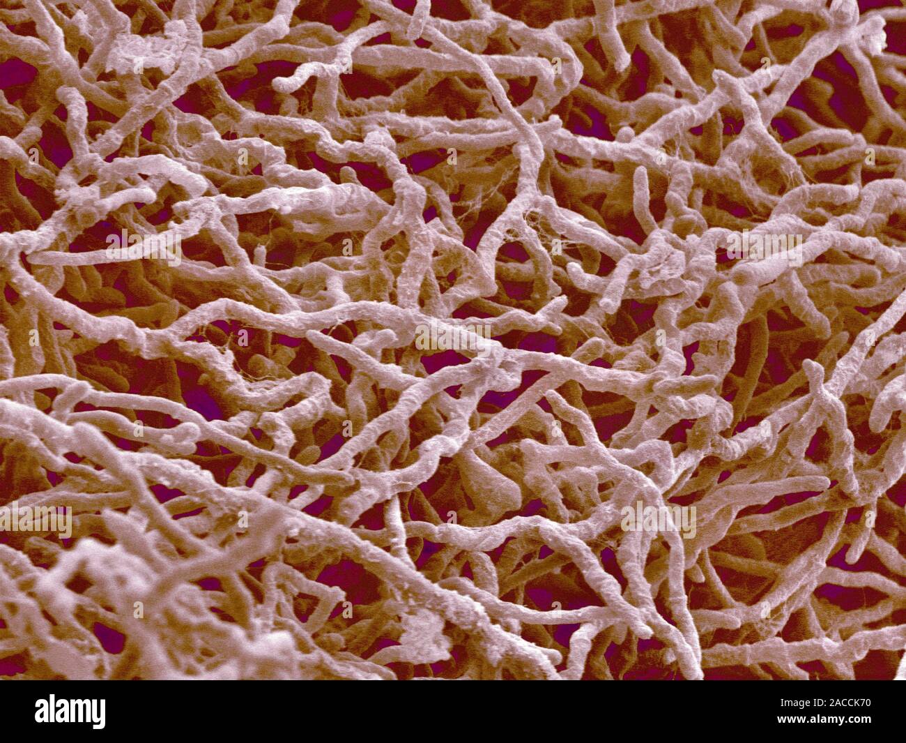 Trichophyton fungus. Coloured scanning electron micrograph (SEM) of a ...