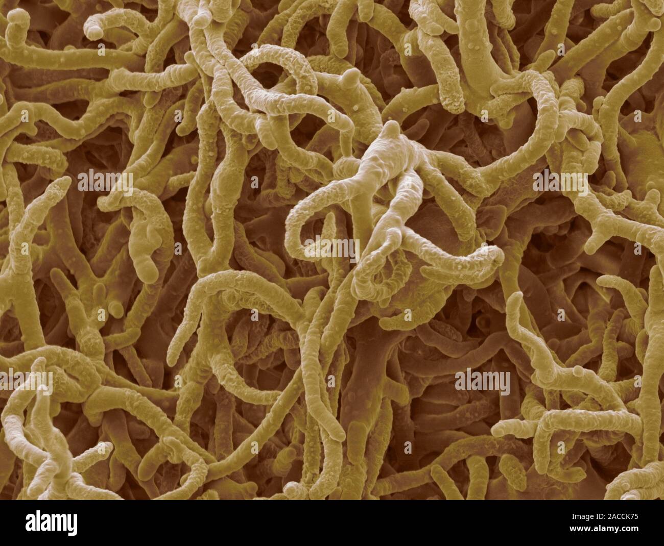 Fungal hyphae. Coloured scanning electron micrograph (SEM) of the ...