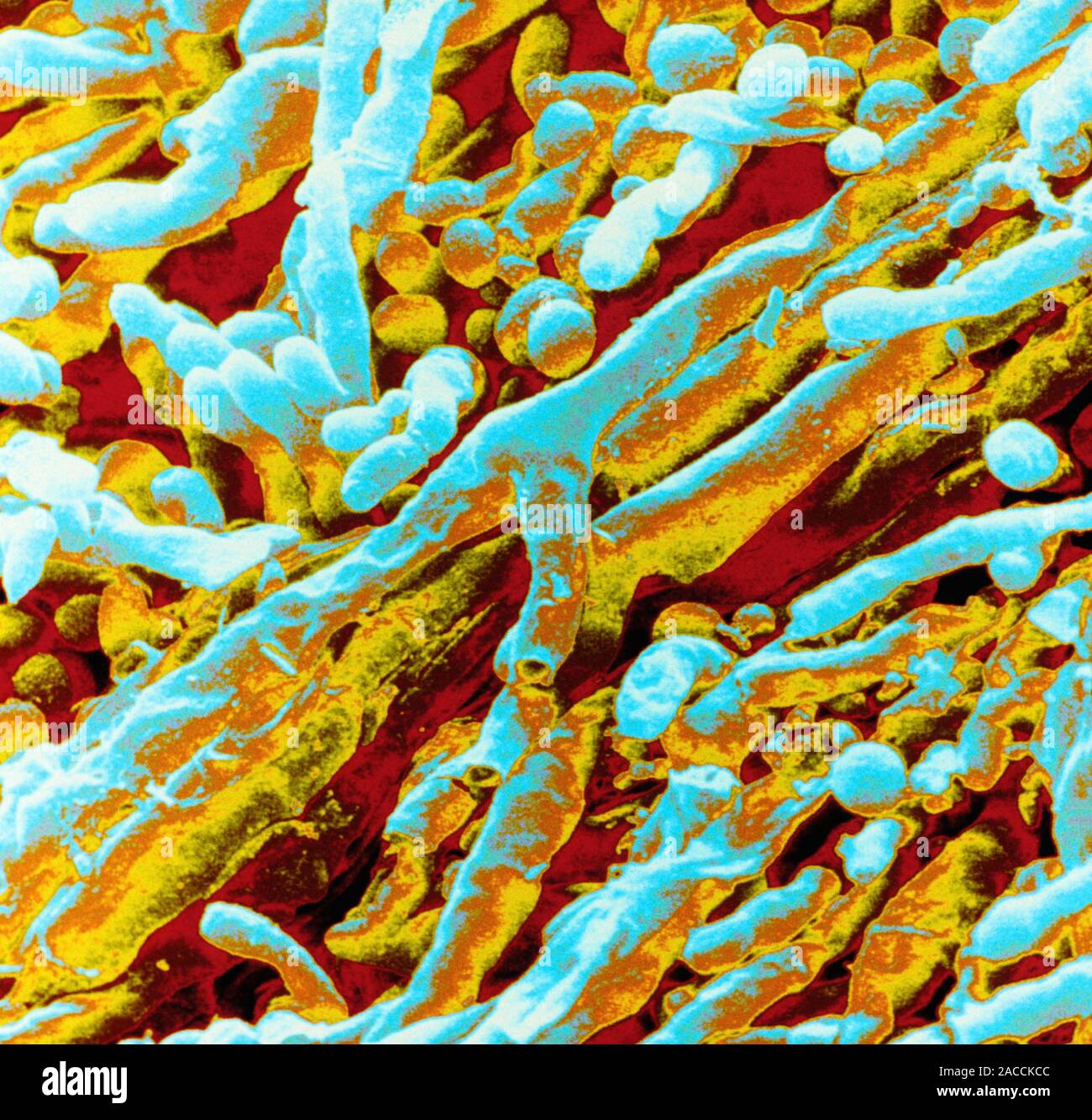 Mould on a lemon. Coloured scanning electron micrograph (SEM) of mould ...