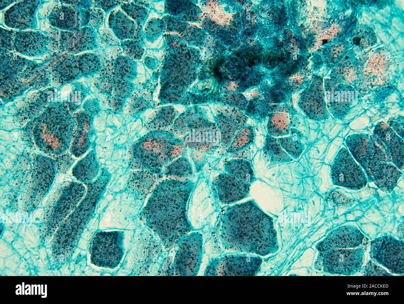 Light micrograph of the root of a cabbage infected with the parasitic ...