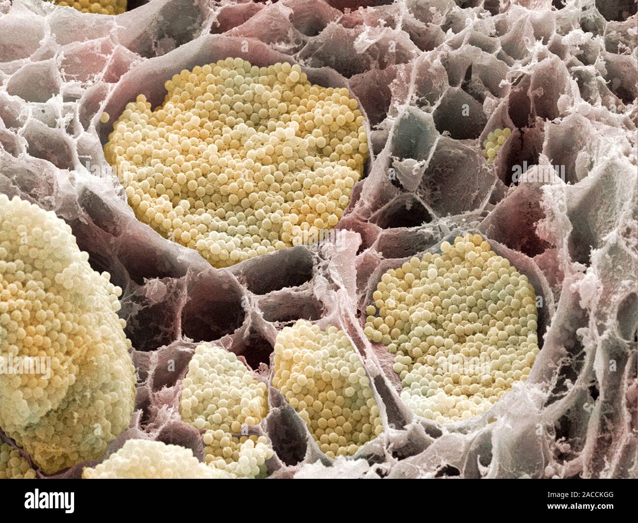 Cabbage root infection. Coloured scanning electron micrograph (SEM) of ...
