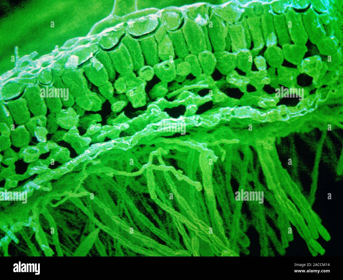 Mildew on leaf. False-colour scanning electron micrograph (SEM) of a ...