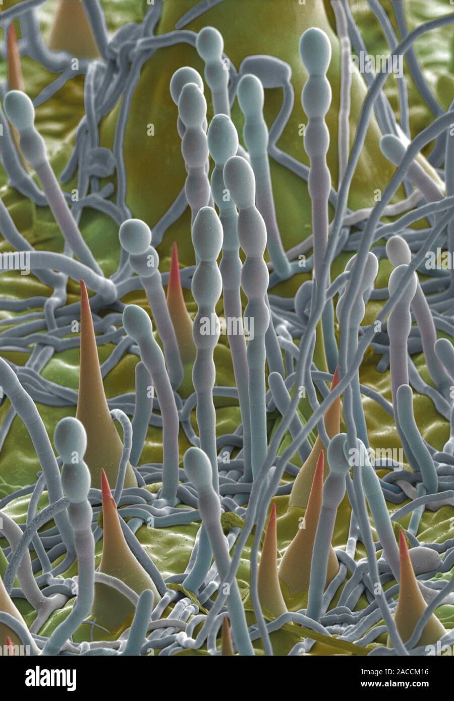 Powdery mildew. Coloured scanning electron micrograph (SEM) of the ...