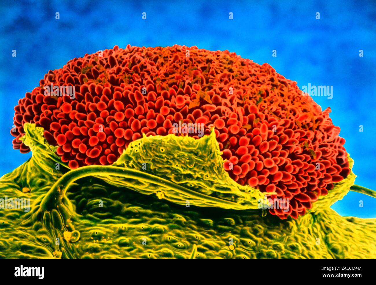 Rust fungus. Coloured scanning electron micrograph (SEM) of the fungus ...