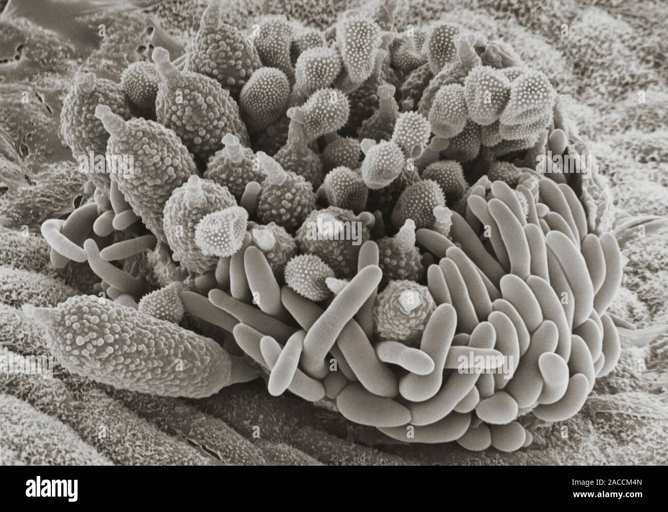 Rust fungus spores. Scanning Electron Micrograph of two spore types ...