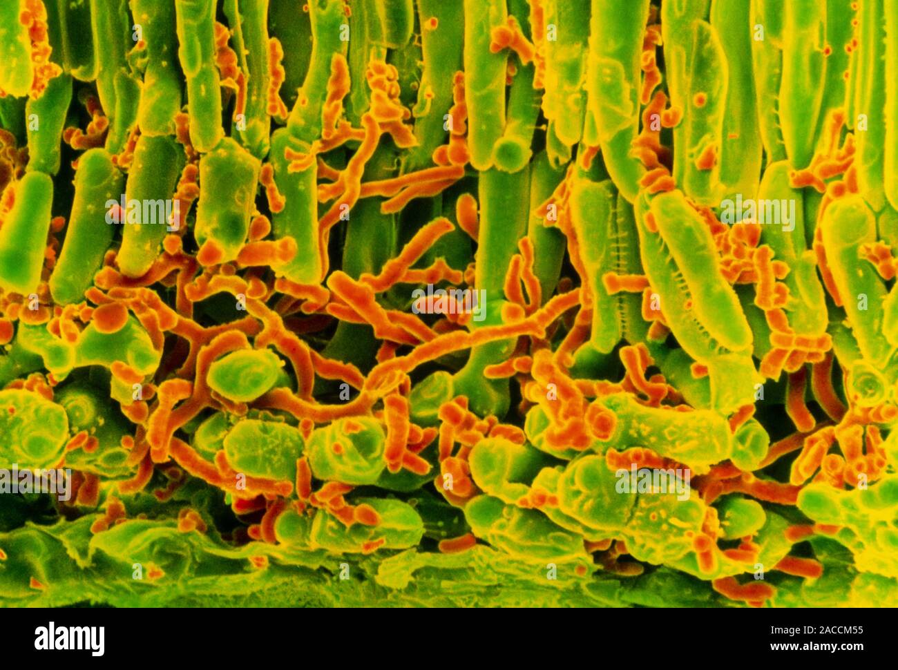 Rust fungus leaf infection. Coloured scanning electron micrograph (SEM ...
