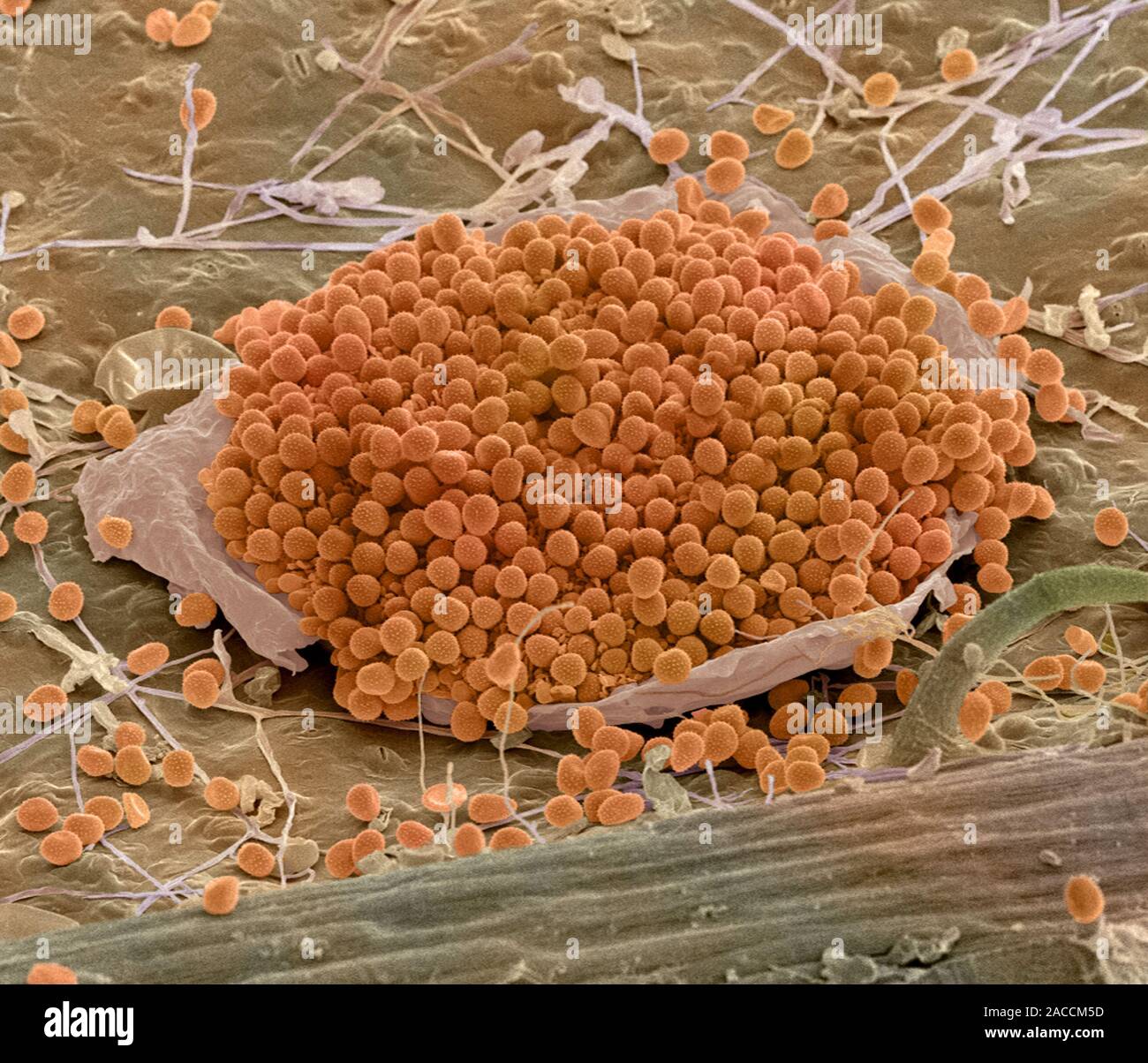 Rust fungus. Coloured scanning electron micrograph (SEM) of spores of ...