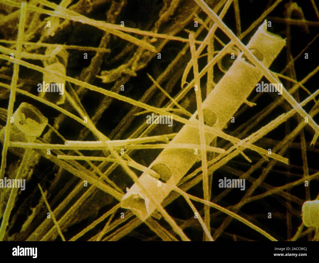 Phytoplankton. Coloured scanning electron micrograph of unidentified ...