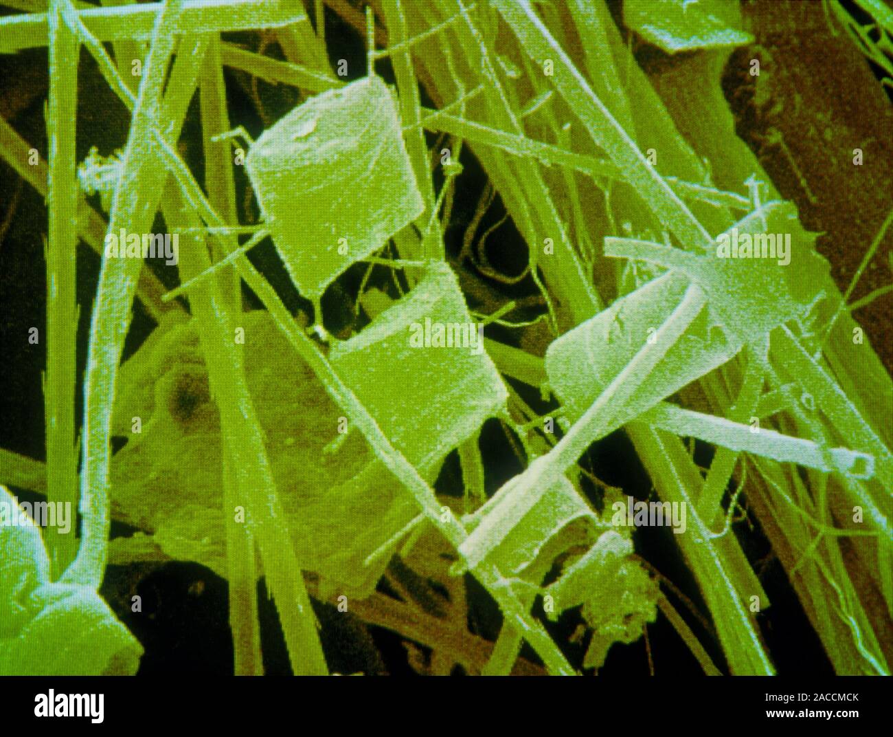 Phytoplankton. Coloured scanning electron micrograph of unidentified ...