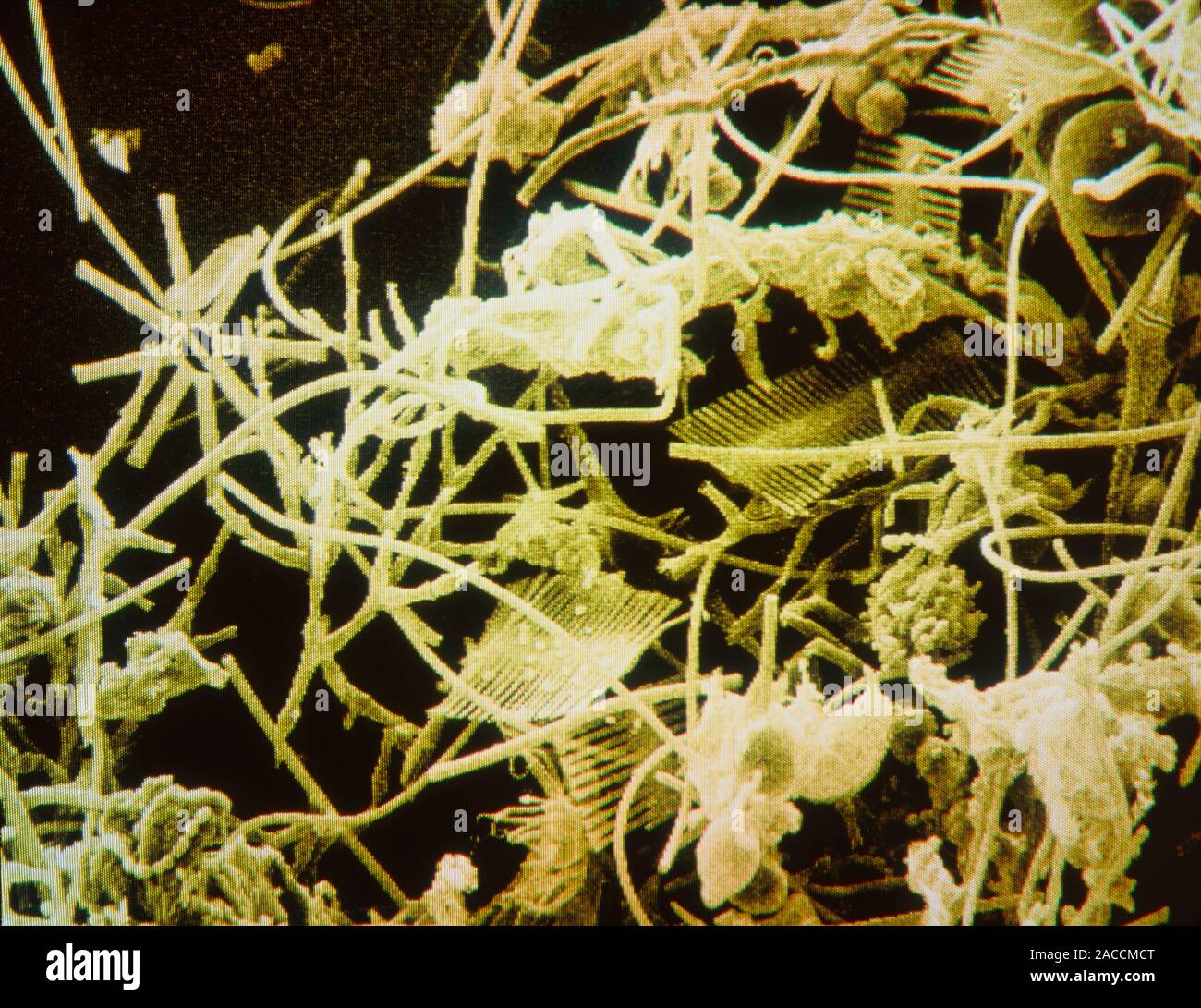 Phytoplankton. Coloured scanning electron micrograph of unidentified ...