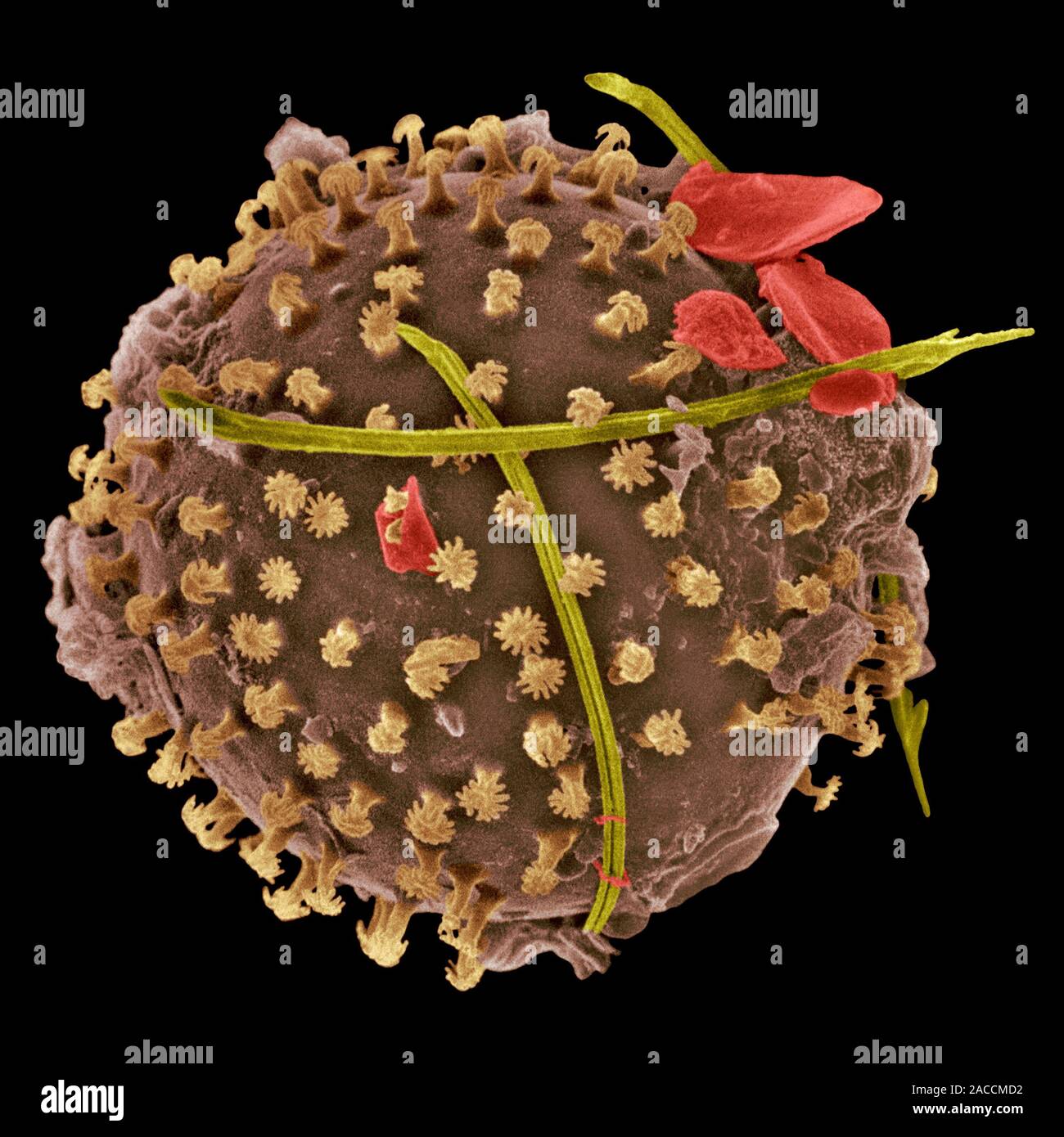 Alga statocyst. Coloured scanning electron micrograph (SEM) of the ...