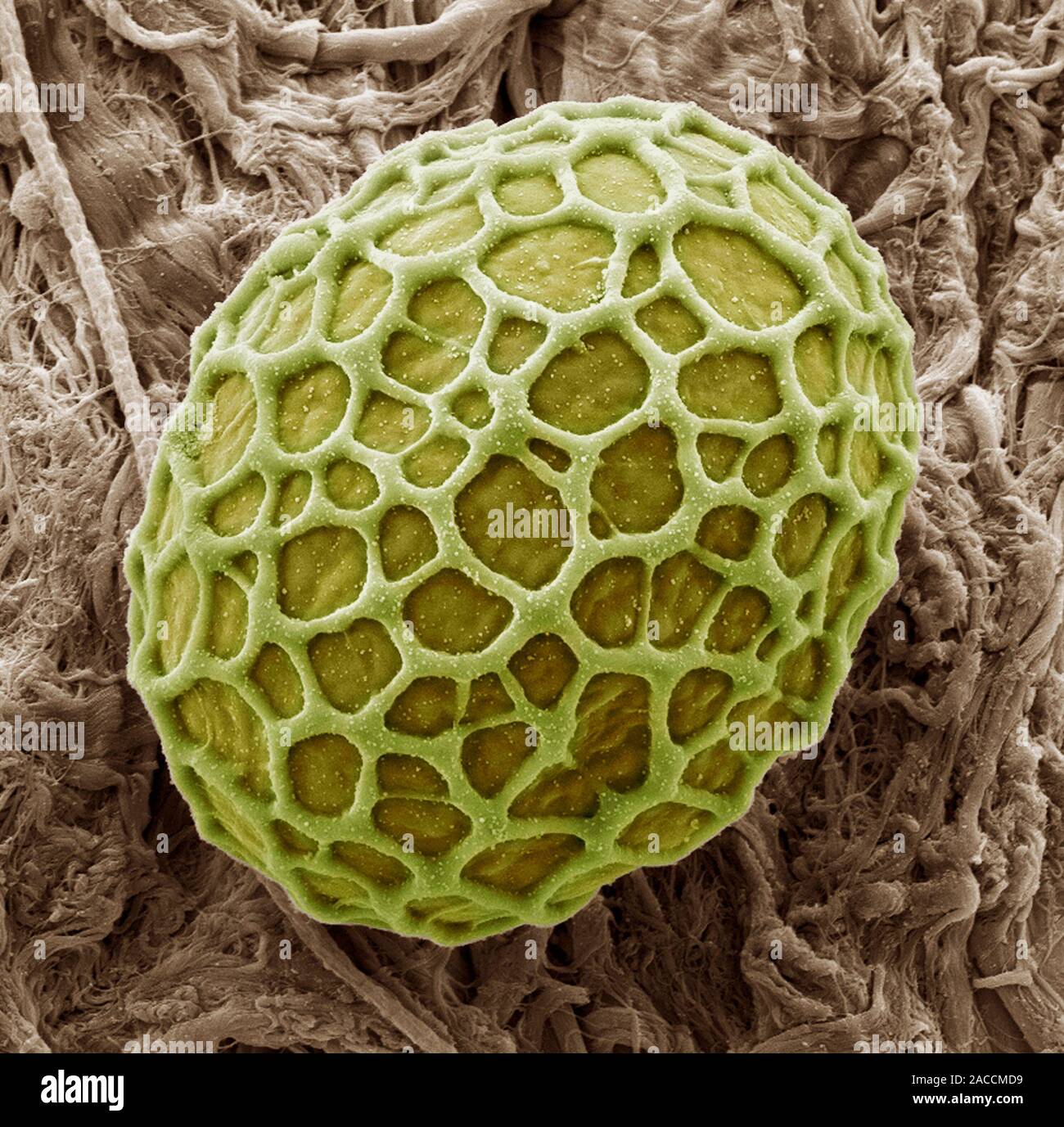 Freshwater alga. Coloured scanning electron micrograph (SEM) of a ...