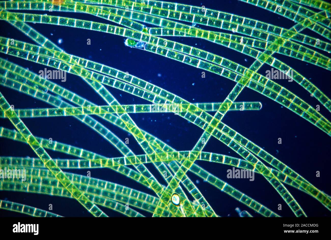 Light micrograph of the common green filamentous alga Zygnema ...