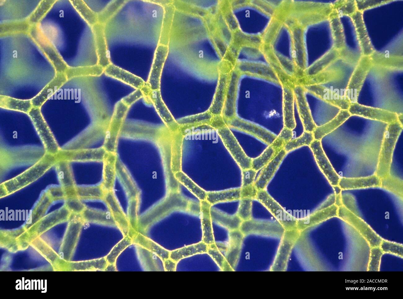 Light micrograph of Hydrodictyon sp. , a freshwater green algae also ...