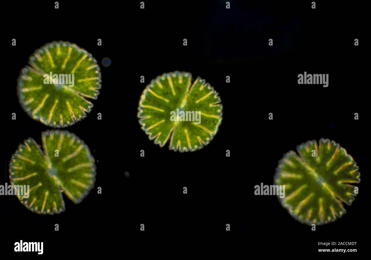 Light micrograph of some Desmids, a collective name given to a group of ...