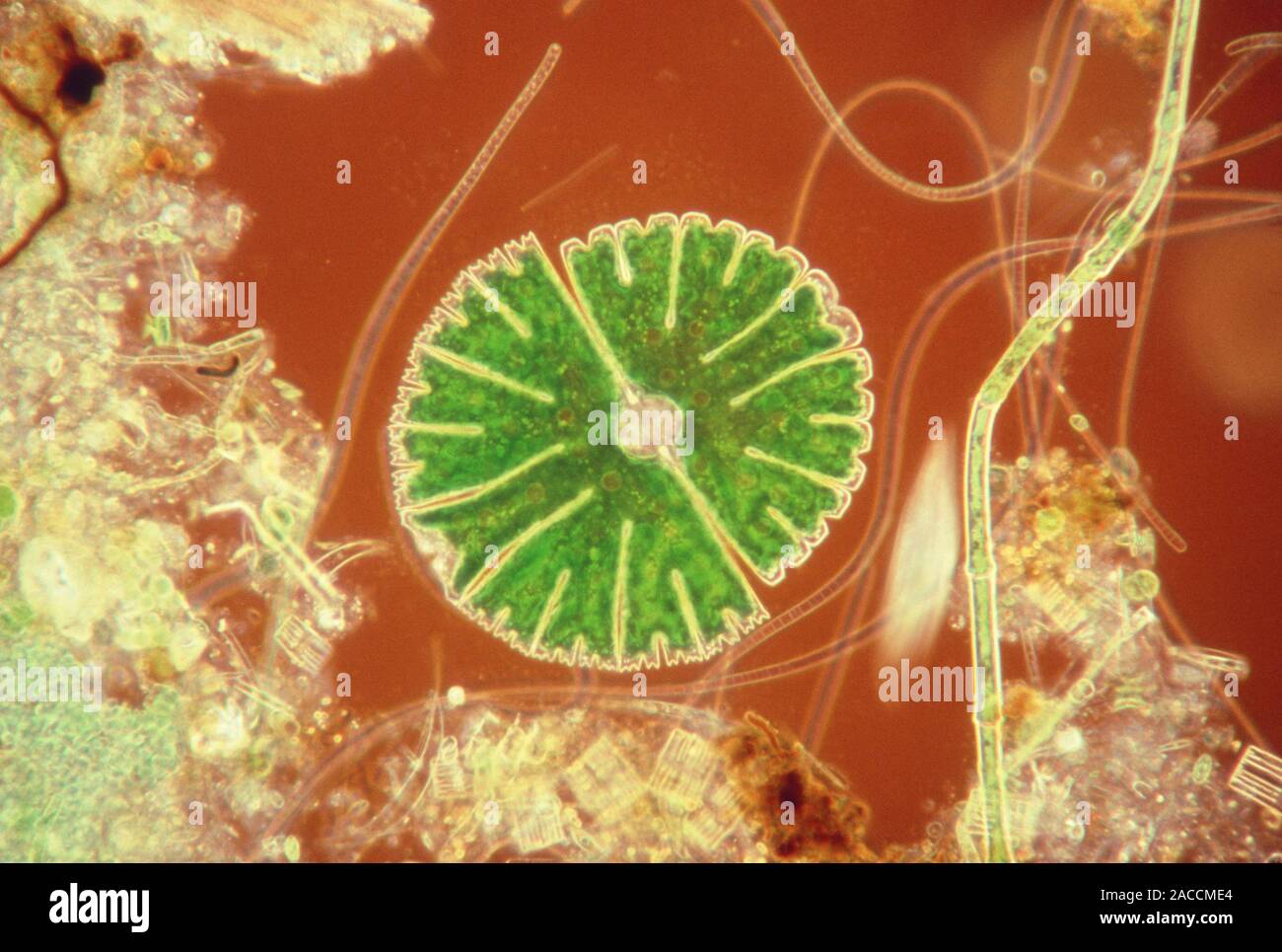 Light micrograph of the desmid Micrasterias sp seen among filamentous ...