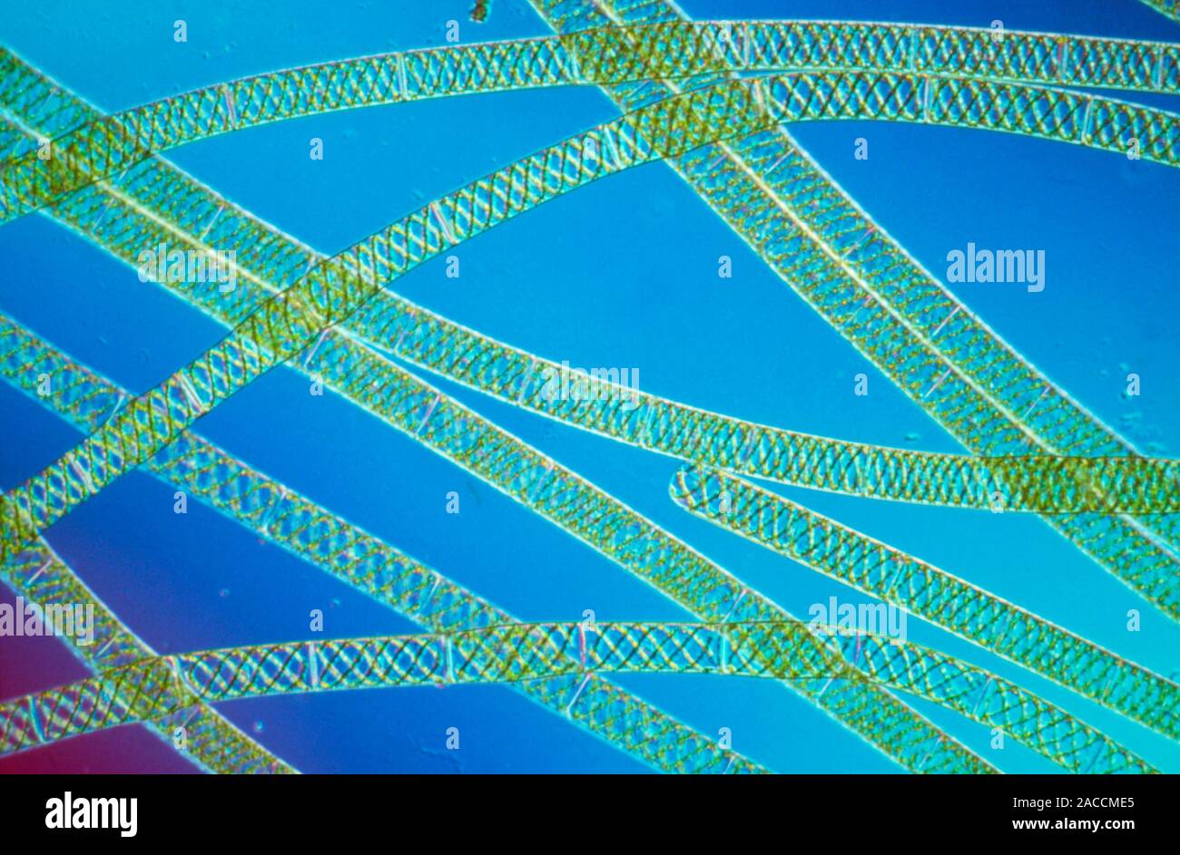 Light micrograph of filaments of Spirogyra, a green algae which form ...