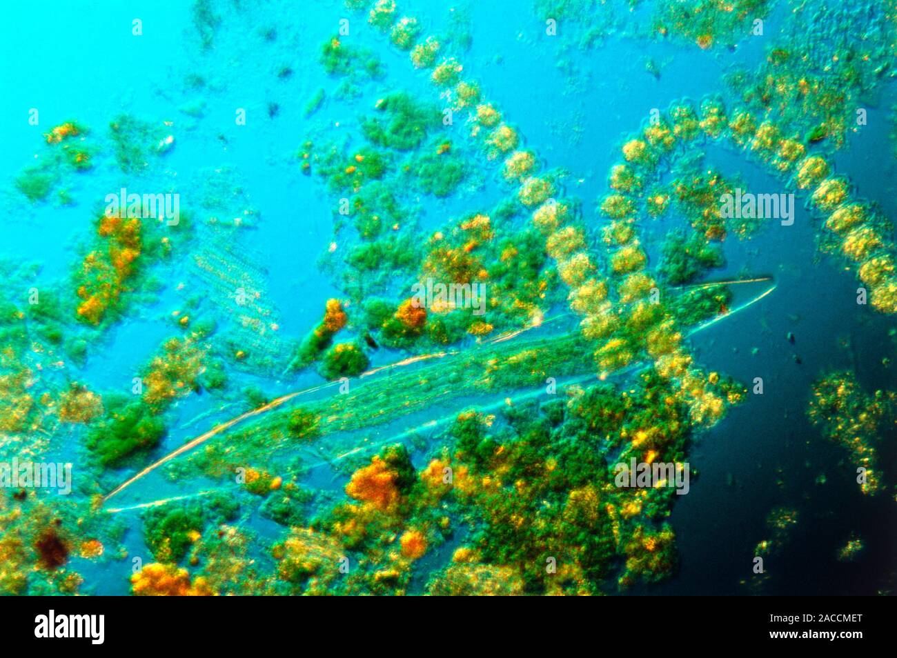 Light micrograph of the freshwater green algae Closterium acerosum, an ...