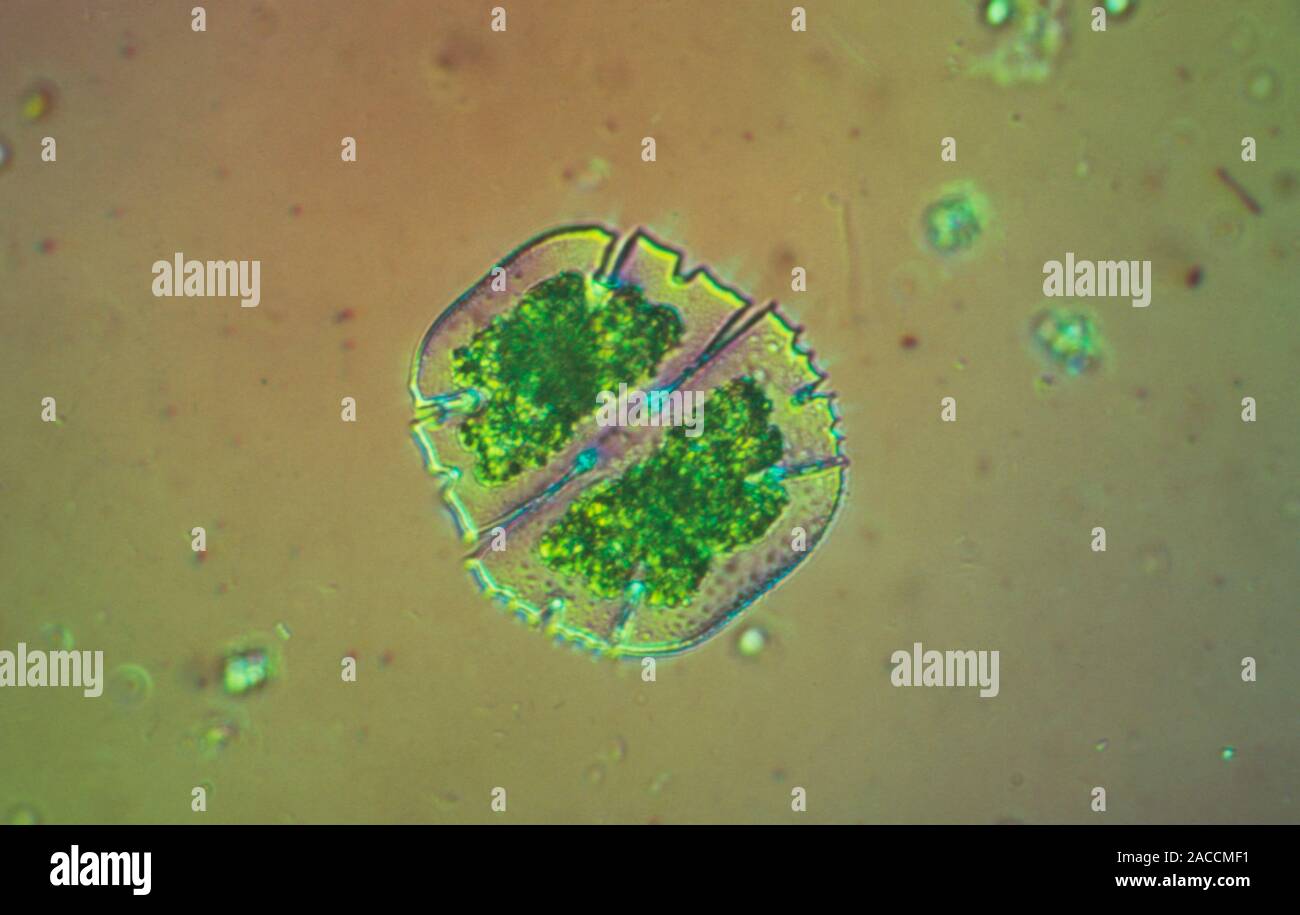 Light micrograph of an unidentified desmid. The desmids are a group of ...