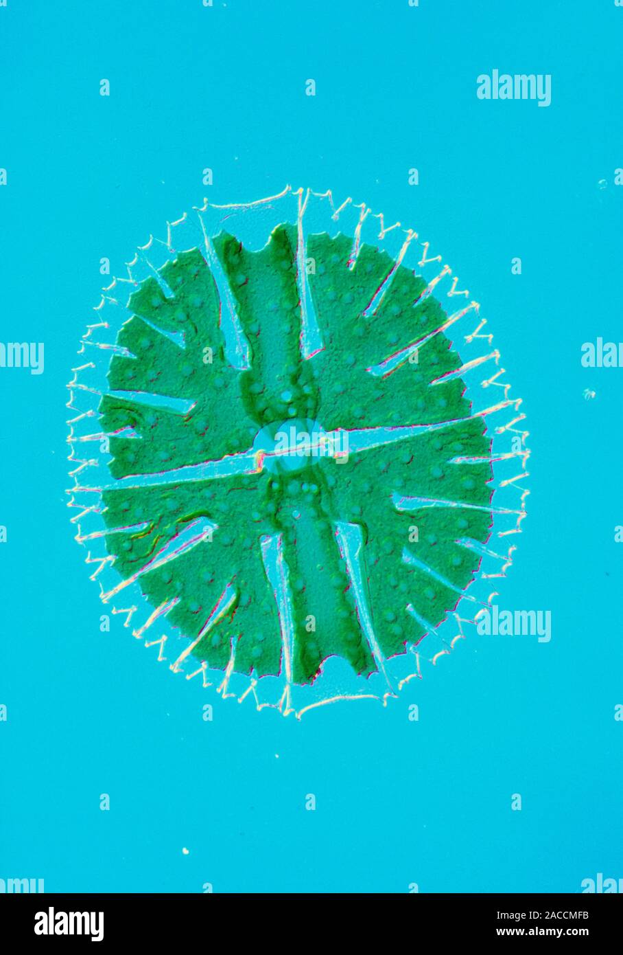 Light micrograph of the desmid Micrasterias rotata. The desmids are a ...