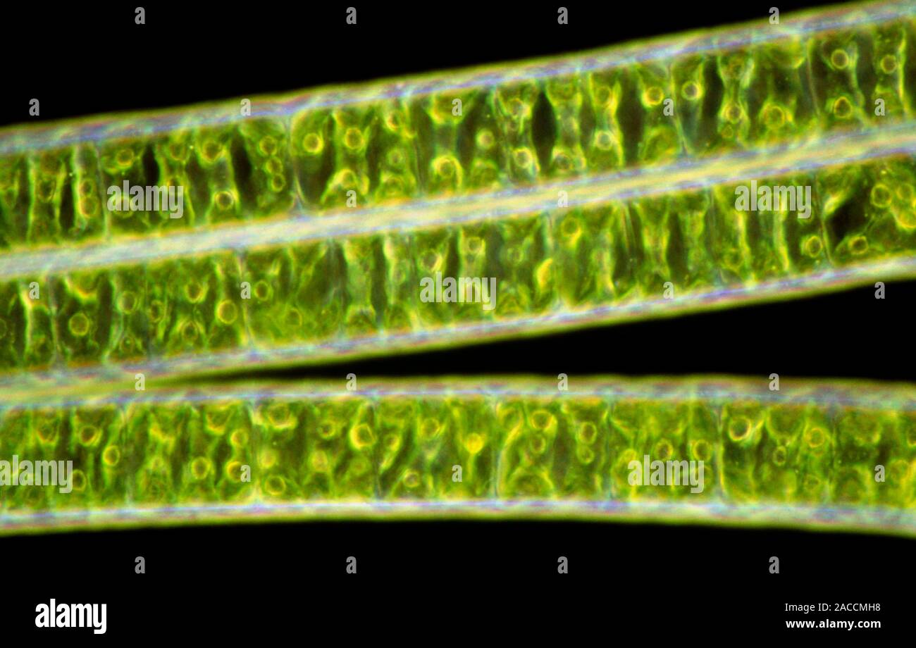 Light micrograph of filaments of Spirogyra, a green alga which forms ...