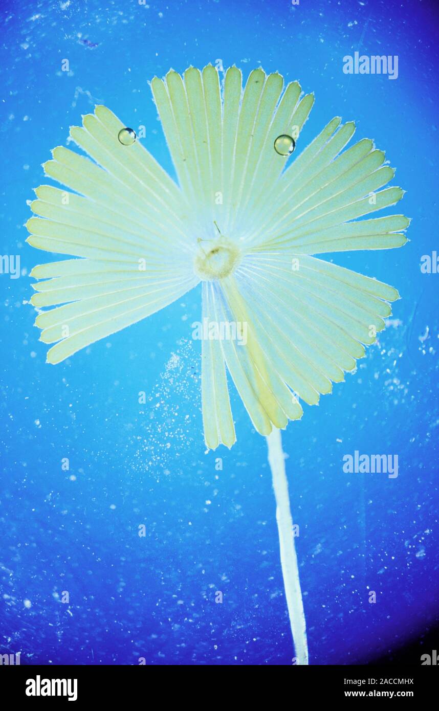 Light micrograph of the one-celled green alga, Acetabularia sp. This ...