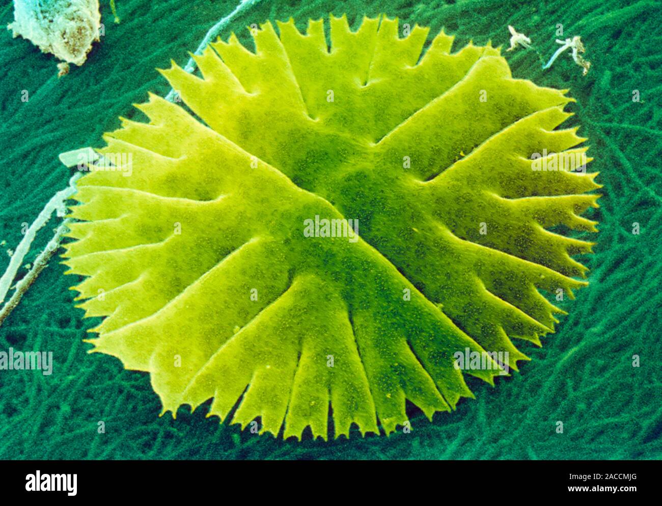 Micrasterias alga. Coloured scanning electron micrograph (SEM) of the ...