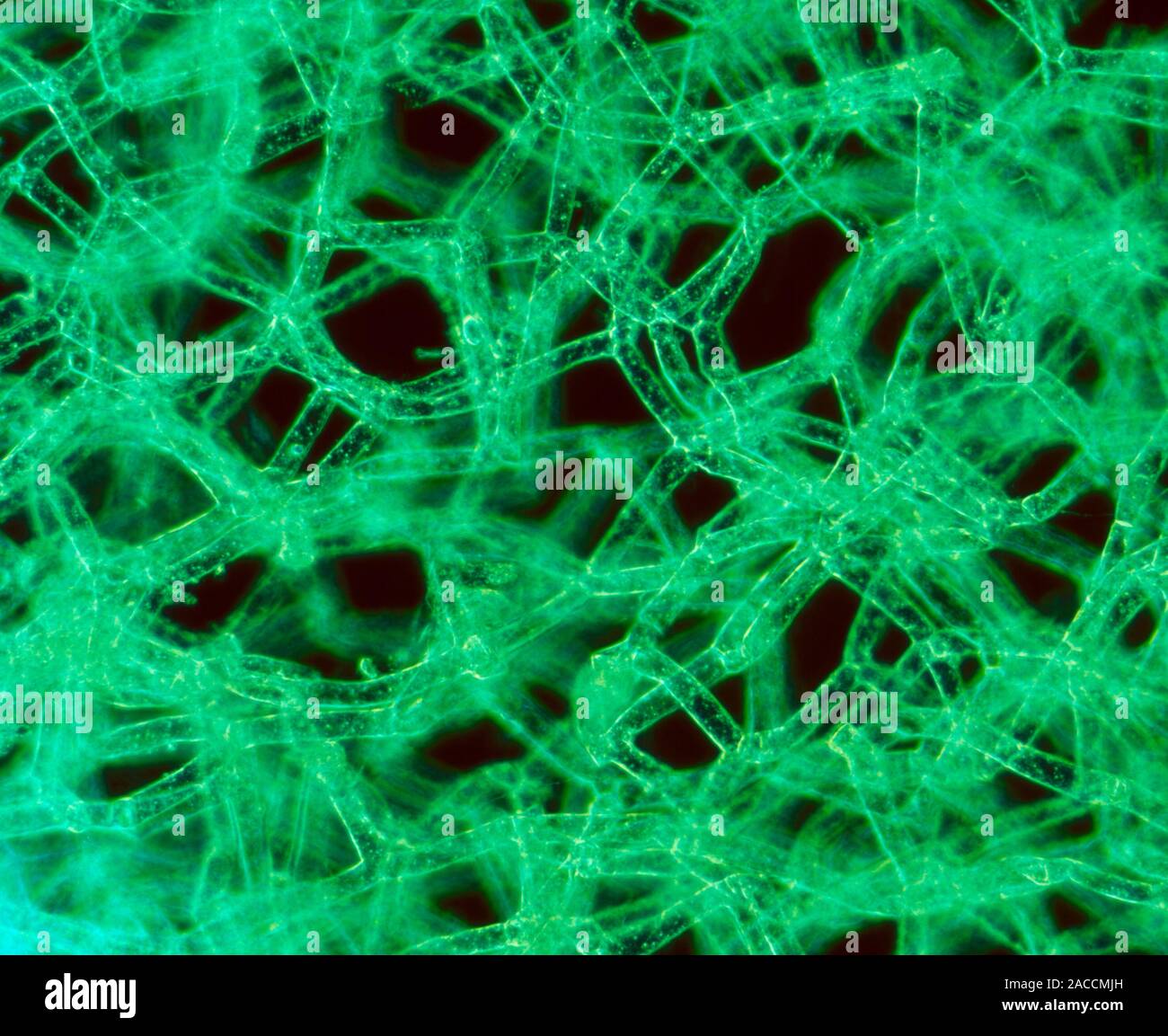 Water net algae. Light micrograph of a colony of water net algae ...