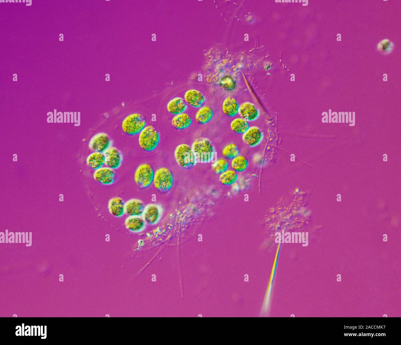 Algal colony. Coloured light micrograph (LM) of a colony of the green ...