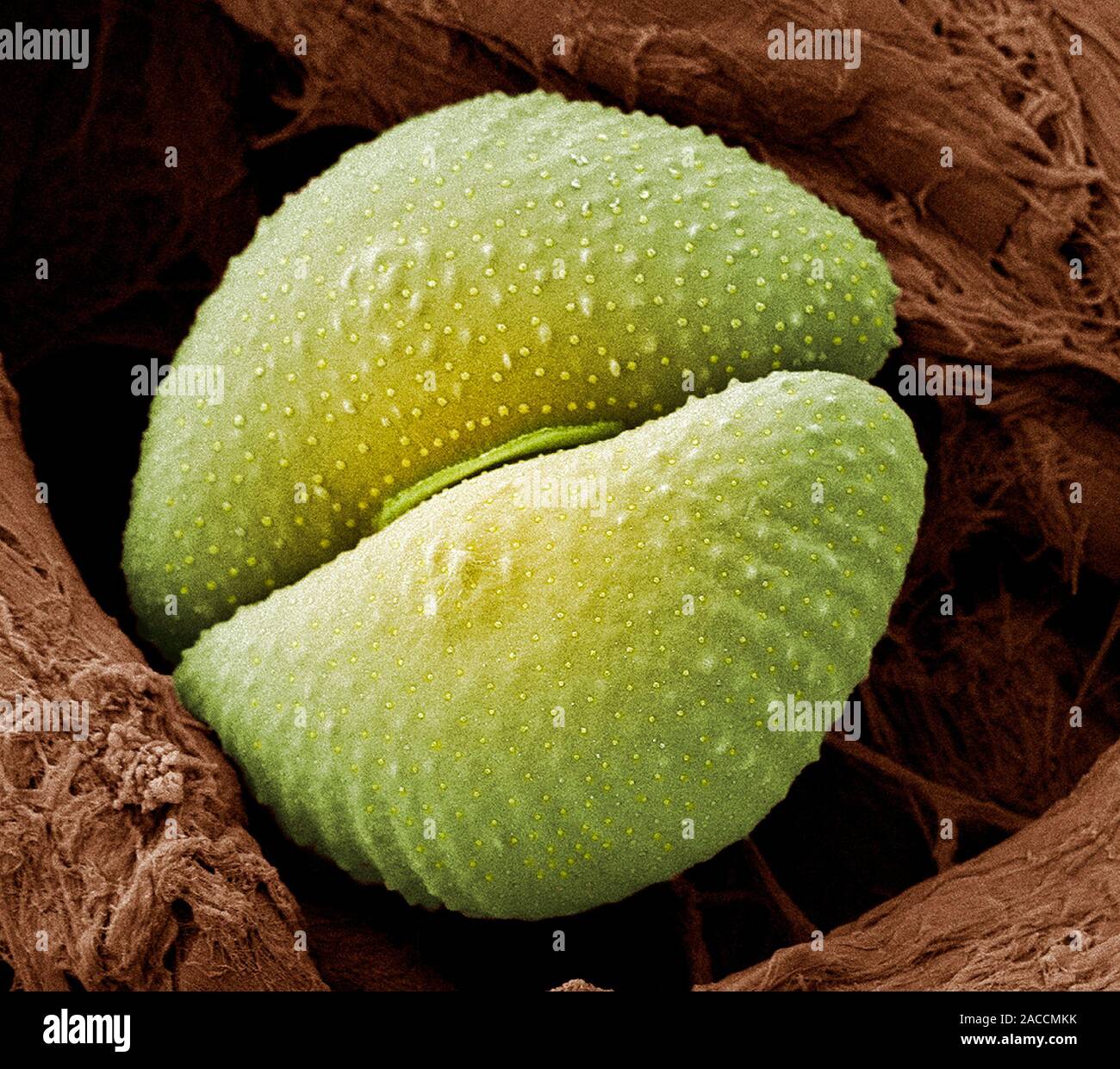 Desmid. Coloured scanning electron micrograph (SEM) of a desmid ...