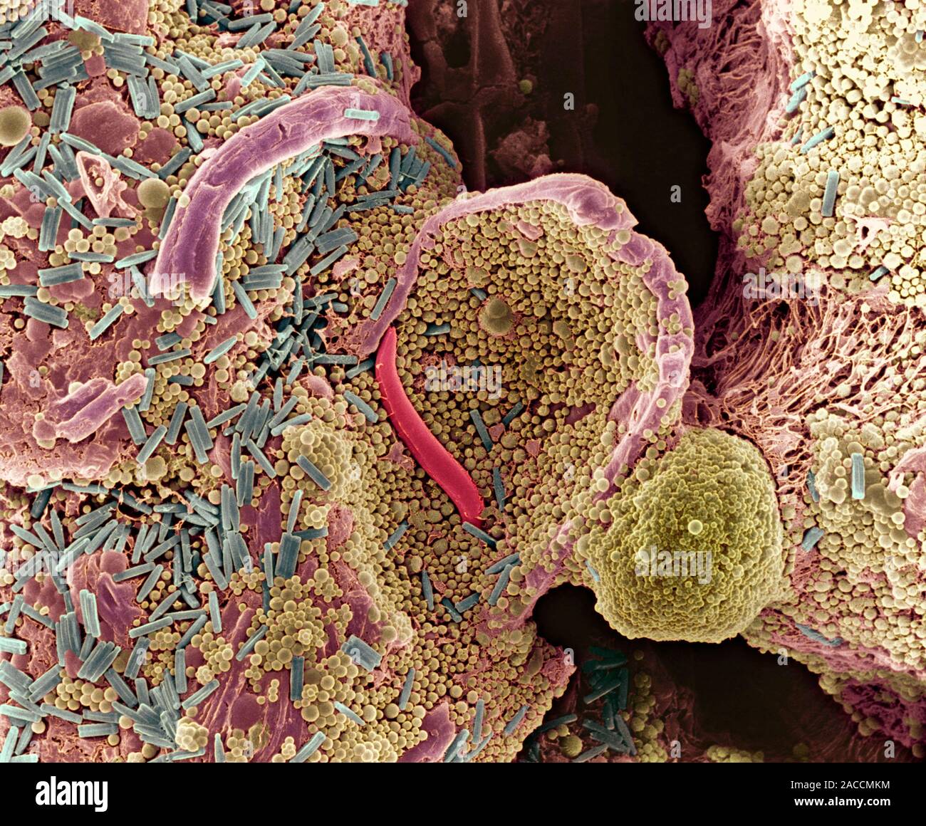 Algae in soil. Coloured scanning electron micrograph (SEM) of peat in a ...