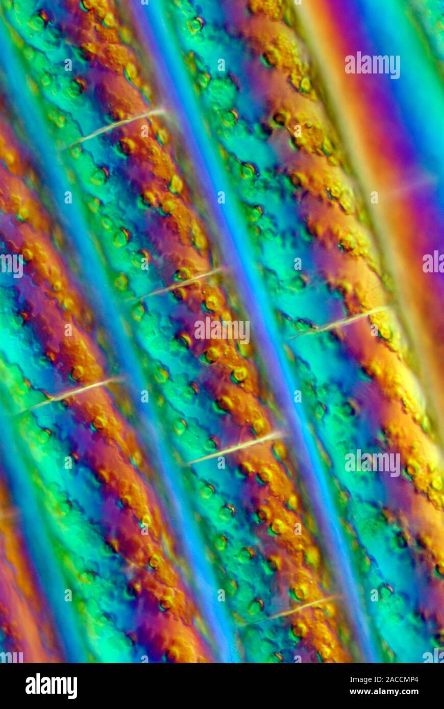 Spirogyra algae. Interference contrast light micrograph of filaments ... Spirogyra algae. Interference contrast light micrograph of filaments ...