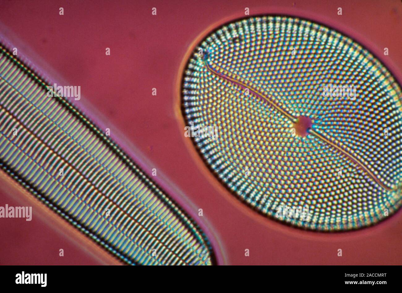 Light micrograph of Diatoms. These are members of the algae, and are of ...