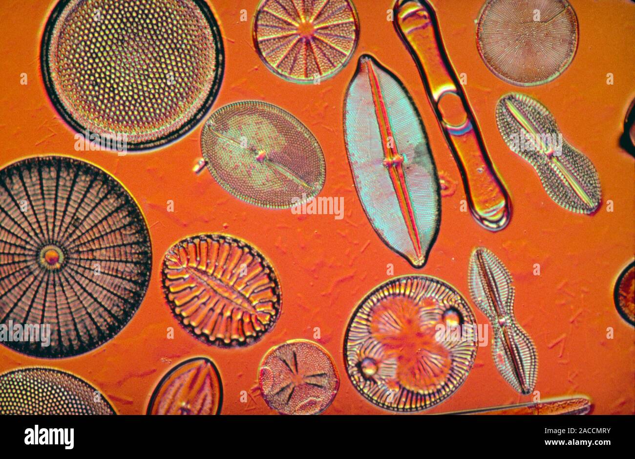 Light micrograph of Diatoms. These are members of the algae, and are of ...