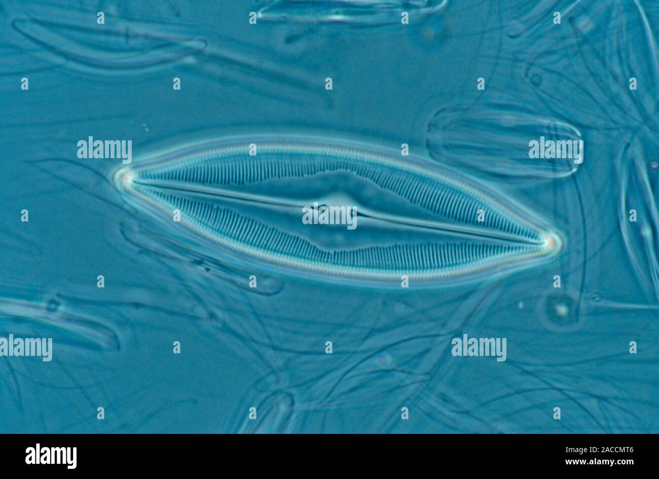 Light micrograph of diatoms, a group of single- celled algae that form ...