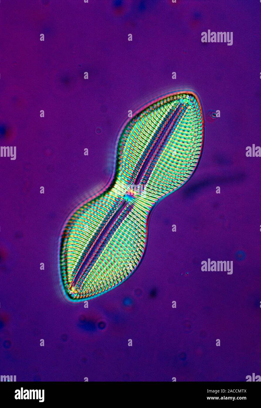Light micrograph of a marine diatom, Navicula sp.. The diatoms are a ...