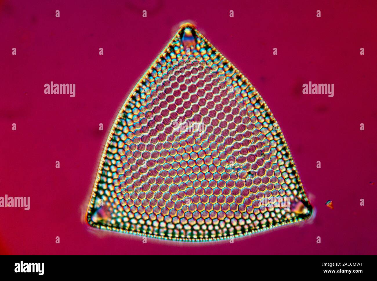 Light micrograph of the diatom Triceratium sp. The diatoms are a ...