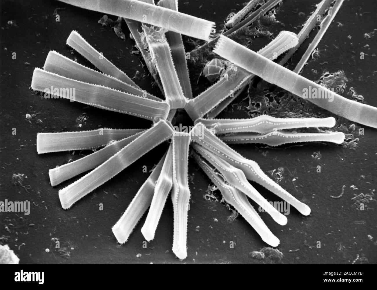 Diatoms. Scanning electron micrograph (SEM) of a group of Tabellaria sp ...