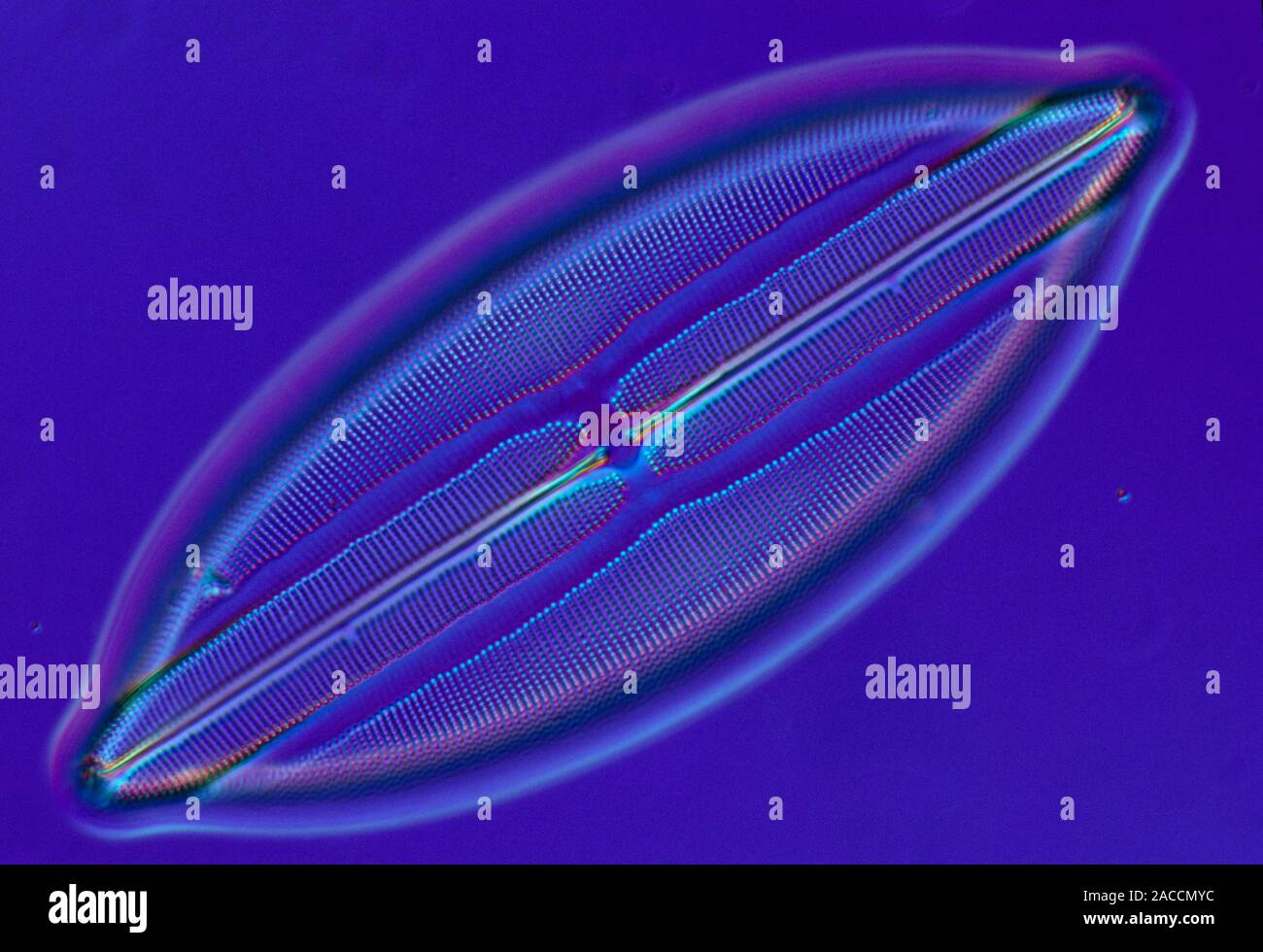 Diatoms Under Microscope Labeled