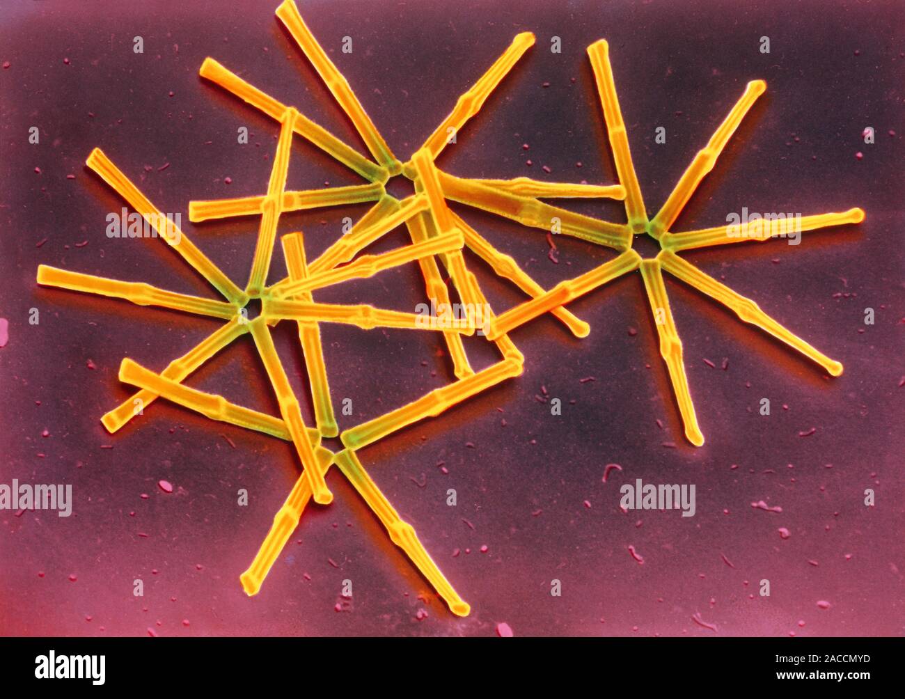 Tabellaria diatoms. Coloured scanning electron micrograph (SEM) of ...