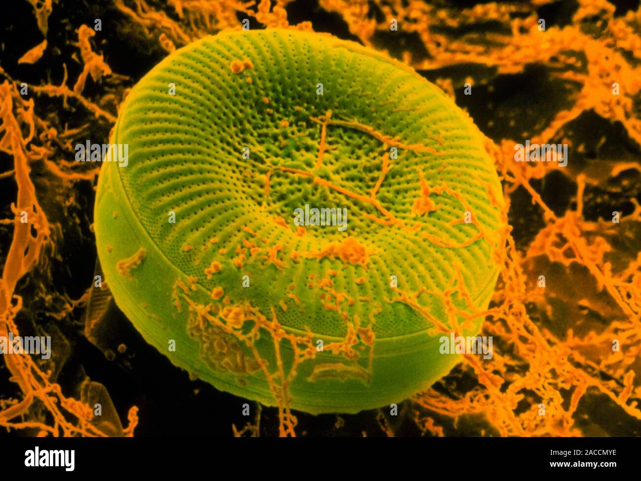 Diatom alga. Coloured scanning electron micrograph (SEM) of an ...